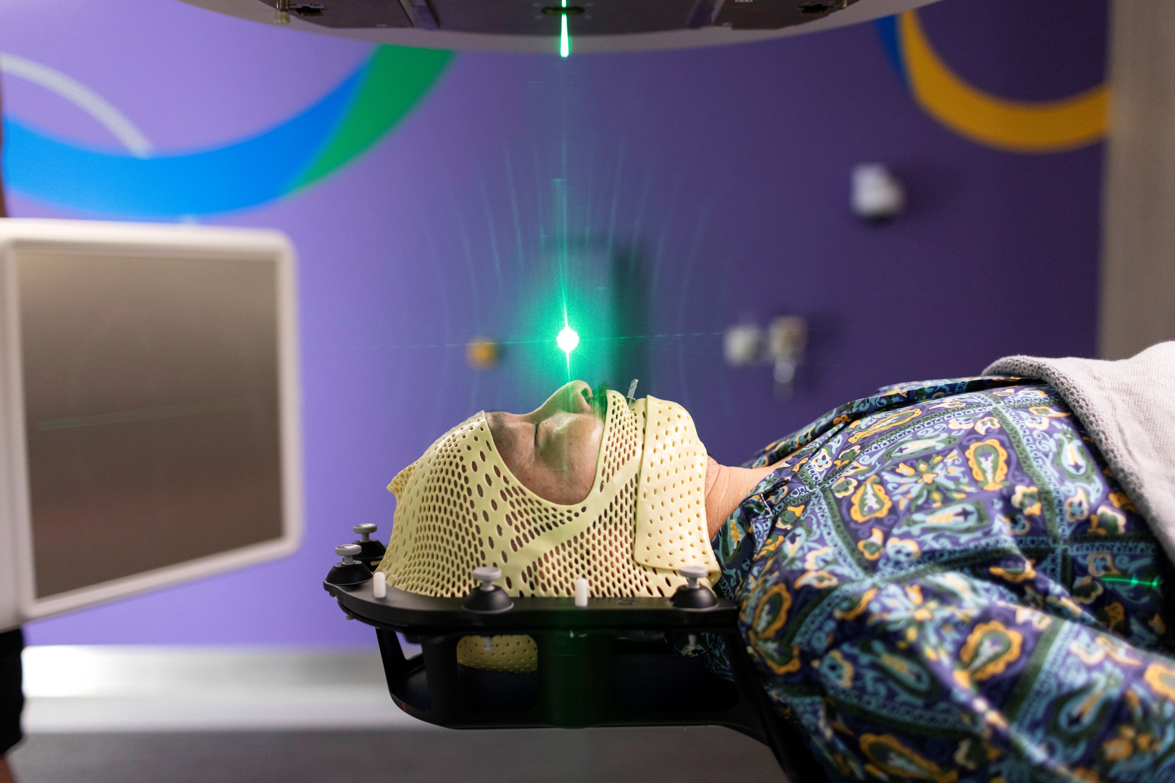 Skin reactions from radiation therapy — Icon Oncology Malaysia